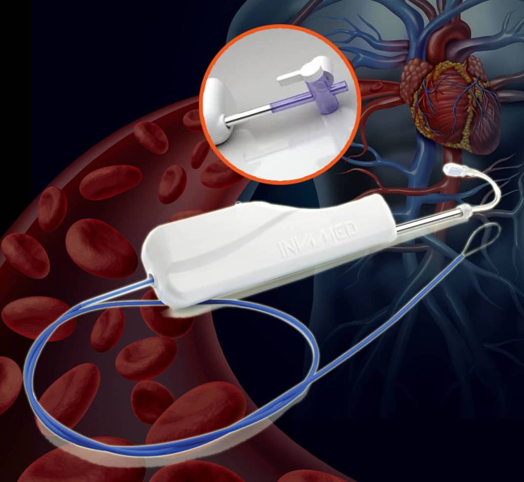 MANTIS – CV Technologies